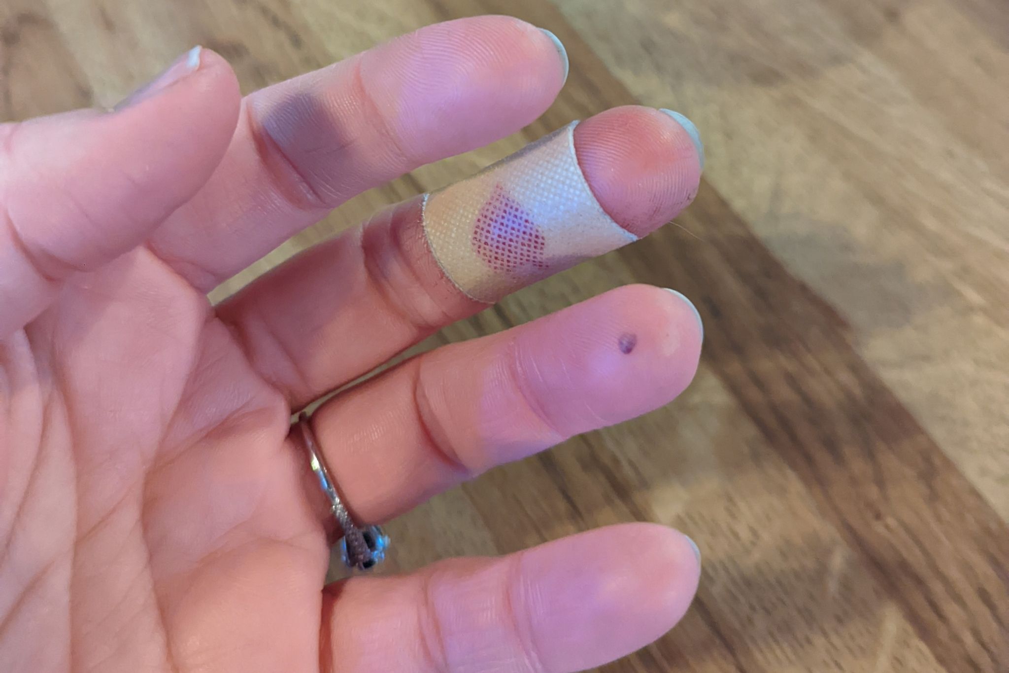 Do Donkeys Bite? (And How to Keep Your Fingers!) - Horse Rookie